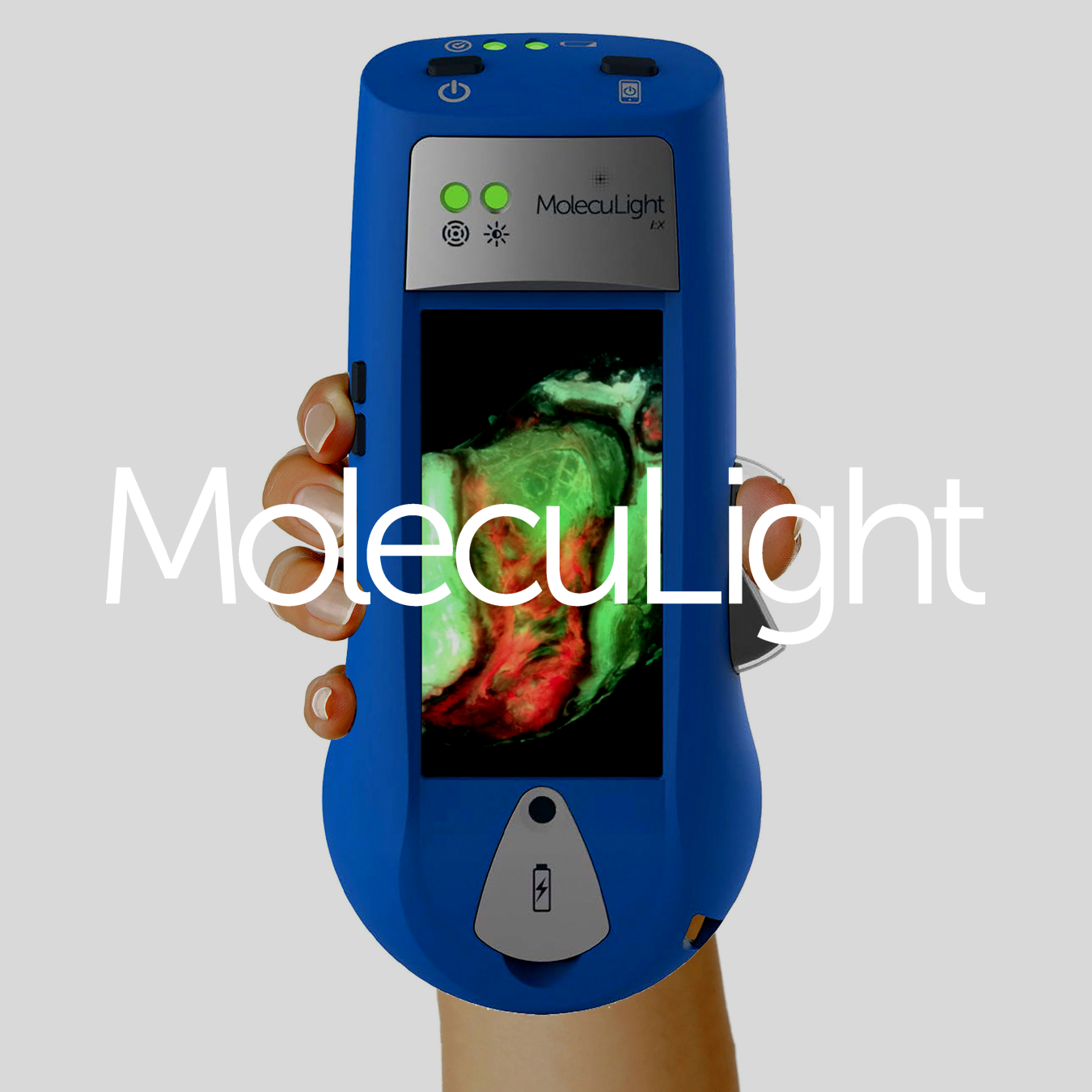 New MolecuLight i:X® Upgrade Enables Faster, More Accurate Digital ...